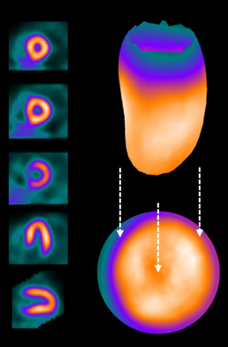 Keeping Pigeons Close to Our Hearts | Psychology Today