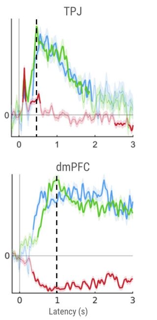 Exploring the Social Brain With Electrocorticography | Psychology Today