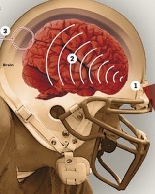 College Football and Traumatic Brain Injury | Psychology Today