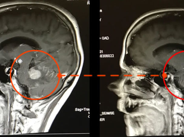 Why Community Support Is Important With Orphan Diseases | Psychology Today