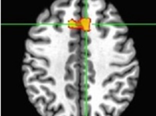 What Can 11 Hours of Meditation Training Do? It Can Rewire Your Brain ...