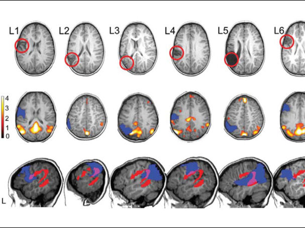 Unused Brain Regions Can Be Repurposed via Neuroplasticity | Psychology ...
