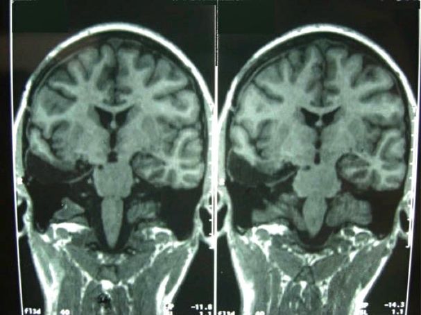 The Imprinted Brain Theory in a Thousand Words | Psychology Today