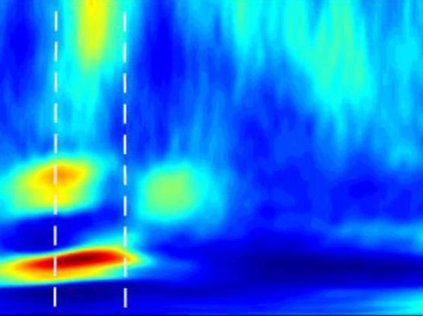 How Early Adversity Relates to Brain Activity Years Later | Psychology ...