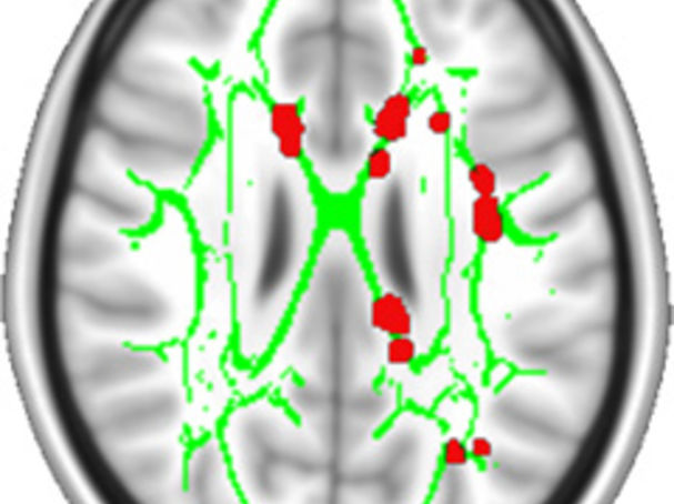 Emotional and Physical Pain Activate Similar Brain Regions | Psychology ...