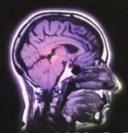 All about Brain Scans | Psychology Today