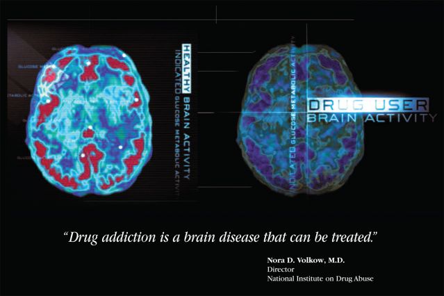 An Addicted Brain Is a Diseased, Not Flawed, Brain | Psychology Today
