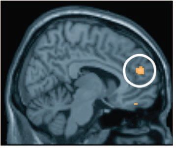 Where Is Catastrophe in My Brain? | Psychology Today