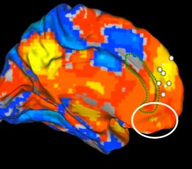 Brain Imaging Reveals the Diametric Mind | Psychology Today UK