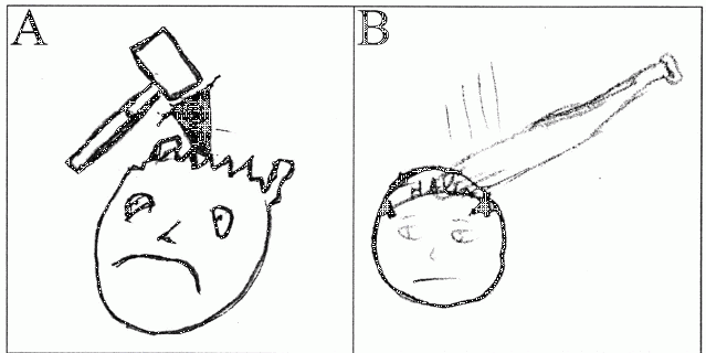 Imagining Pain | Psychology Today