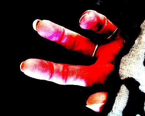 Taphophobia: Fear of Waking inside your Grave | Psychology Today