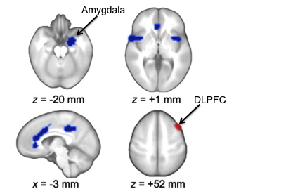 Psychotic Brain Scan