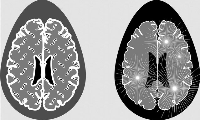 Instability Phenomenon Discovered in AI Image Reconstruction ...