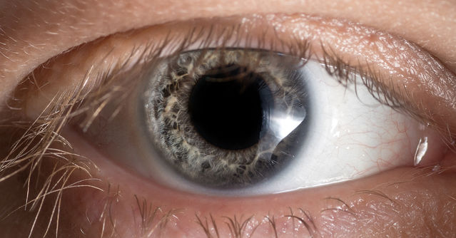 Your Eyes Are a Window Into the Inner Workings of Your Brain ...