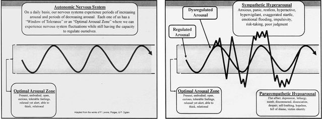 sympathetic hyperarousal