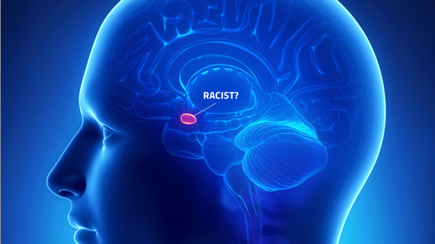 Understanding the Racist Brain | Psychology Today Canada