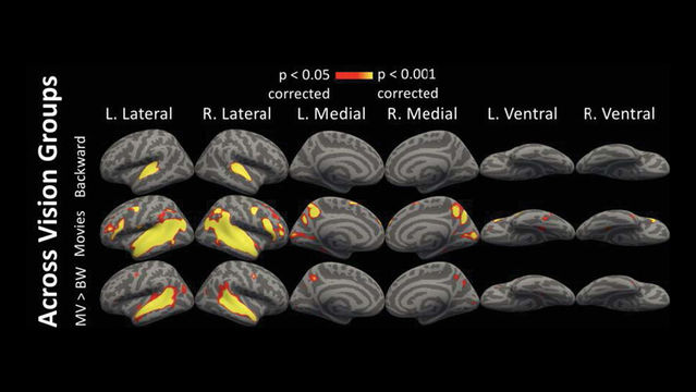 Unused Brain Regions Can Be Repurposed via Neuroplasticity | Psychology ...