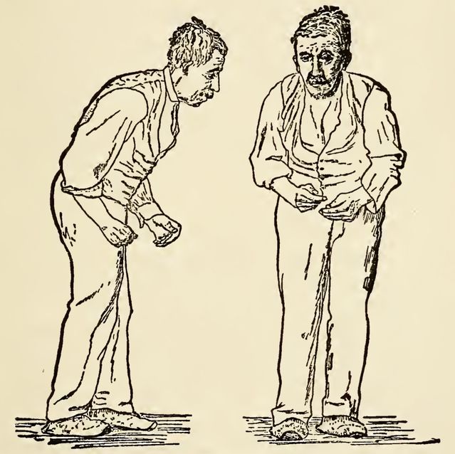 Does Impaired Movement Impair Thinking About Movement? | Psychology Today