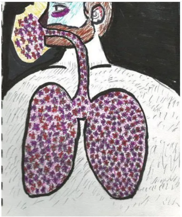 Pain and Emotion: The Role of the Amygdala | Psychology Today