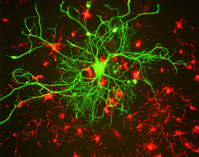 Nature or Nurture? Brain Science and Biological Essentialism ...