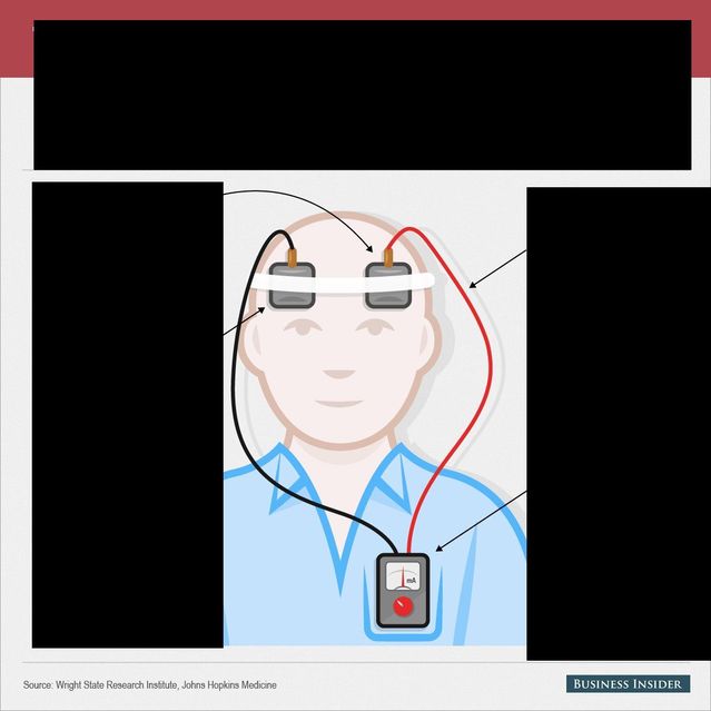 Electro-Cures Largely Unproven | Psychology Today