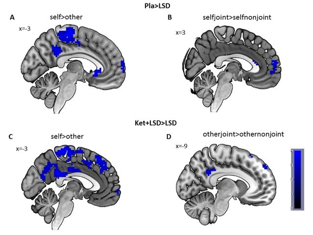 The Neuroscience of LSD Unlocks the Doors of Self-Perception ...