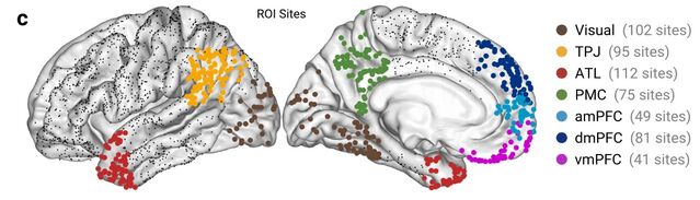 Exploring the Social Brain With Electrocorticography | Psychology Today