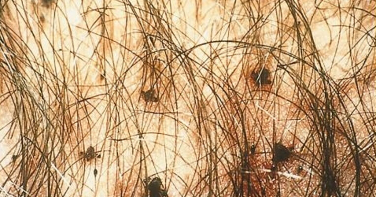 Delusional Infestations and Real Suffering | Psychology Today