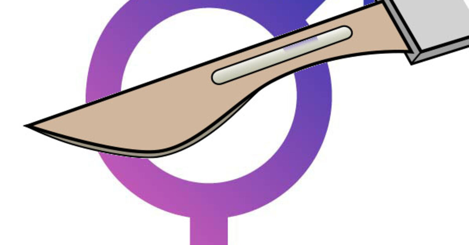 Going Under the Knife for Masculinity or Femininity | Psychology Today UK