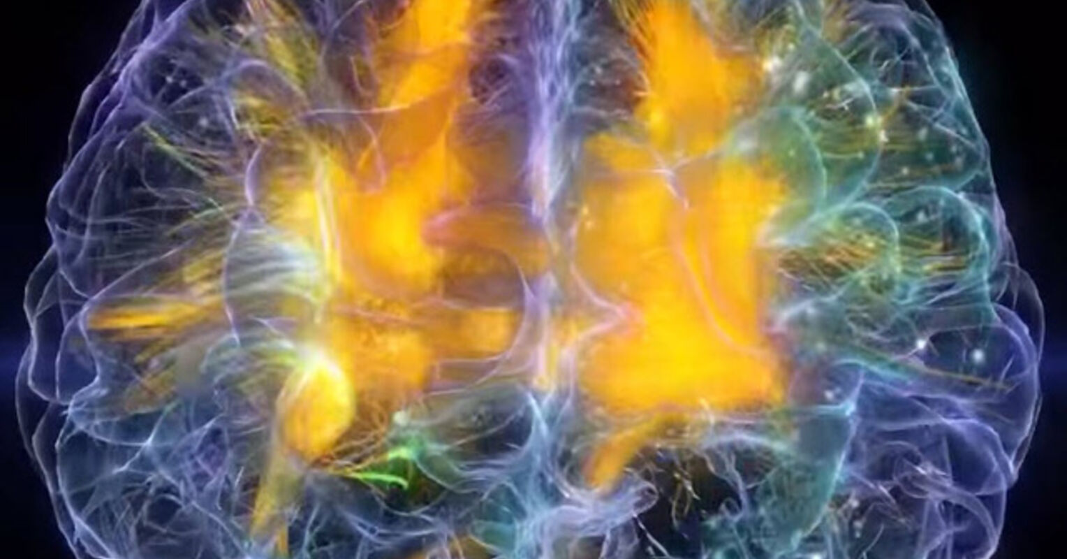 A Beautiful Visualization of Electrical Action in the Brain ...