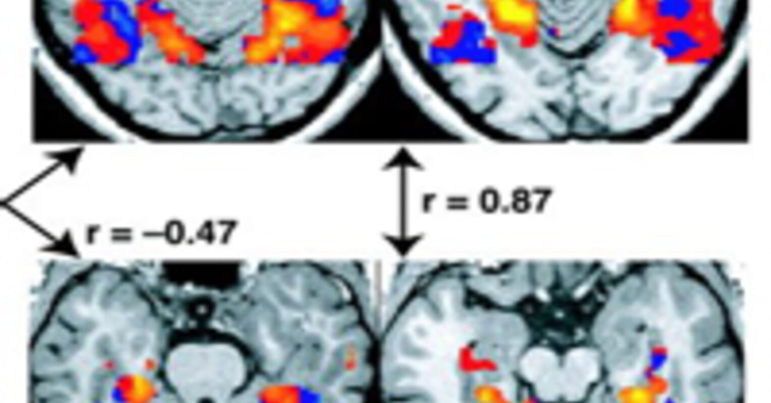 Tens of Thousands of fMRI Studies of the Brain May Be Flawed ...